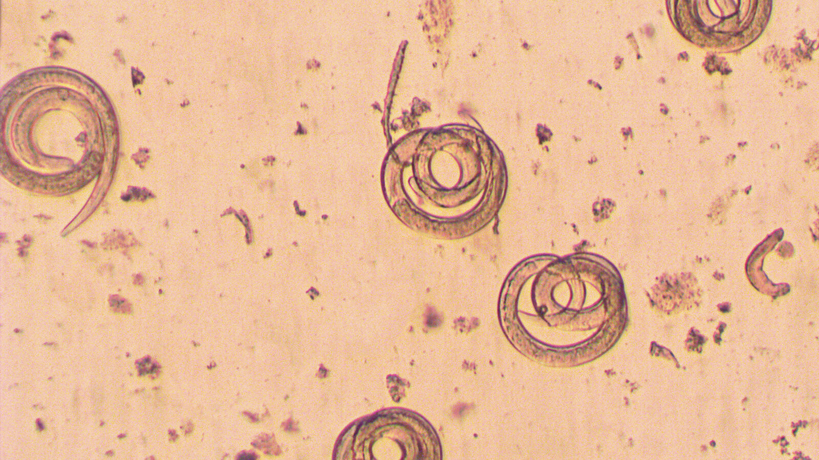 Parasites in food | EFSA
